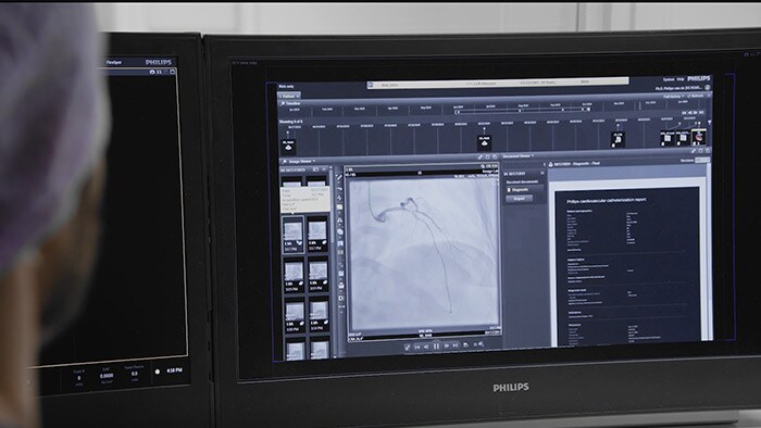 Sala de intervencionismo integrada con Azurion | Philips